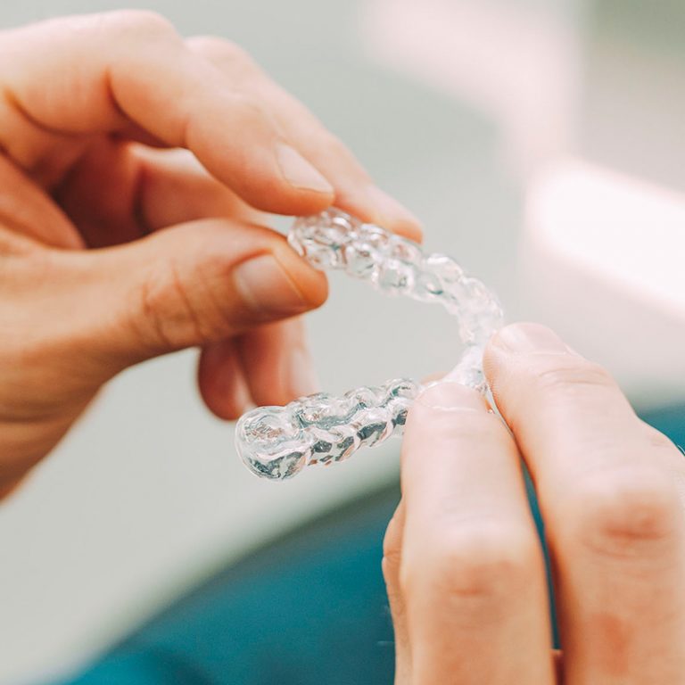Aligner-Schienen Göttingen | die fast unsichtbare Zahnschiene